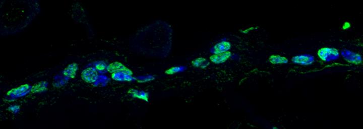 DNA Damage in Mice Skin [IMAGE] | EurekAlert! Science News Releases
