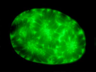 Human Cell Infected by Toxopla [IMAGE] | EurekAlert! Science News Releases