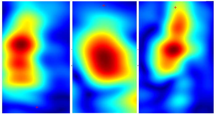 Bye bye biopsy? [IMAGE] | EurekAlert! Science News Releases
