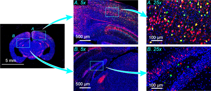 Seeing both the forest and the trees: Trans-s | EurekAlert!