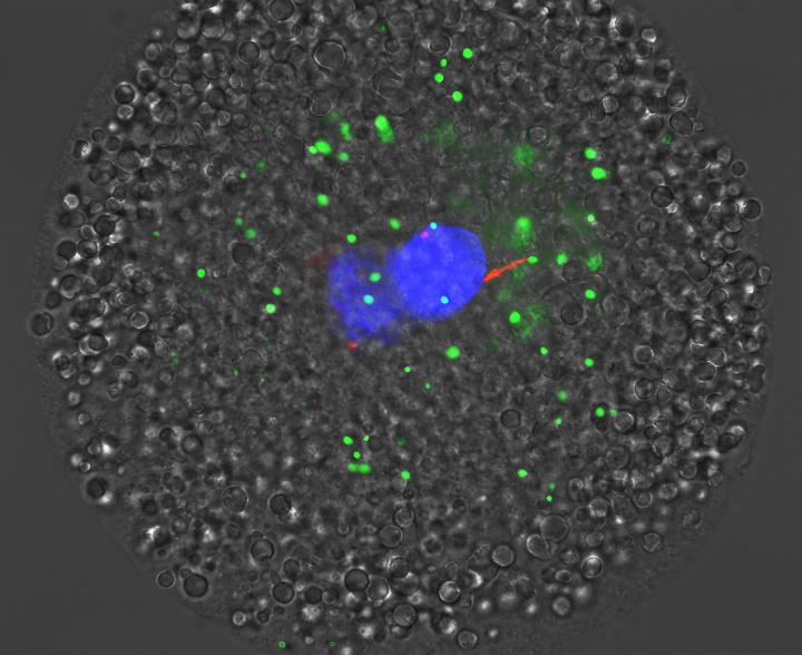 Mitophagy [IMAGE] | EurekAlert! Science News Releases