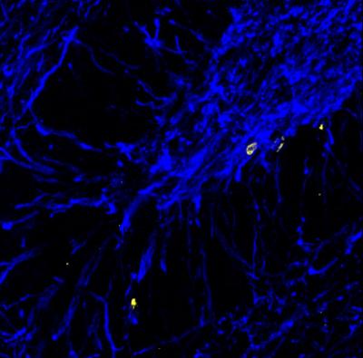 Myelin Staining in Hippocampus [IMAGE] | EurekAlert! Science News Releases