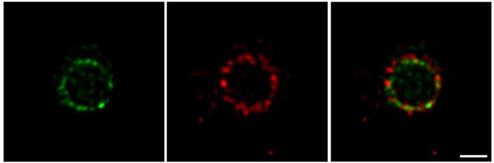 Protein Rings in the E. col [IMAGE] | EurekAlert! Science News Releases