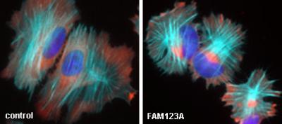 Actin Cytoskeleton Stained Cel [IMAGE] | EurekAlert! Science News Releases