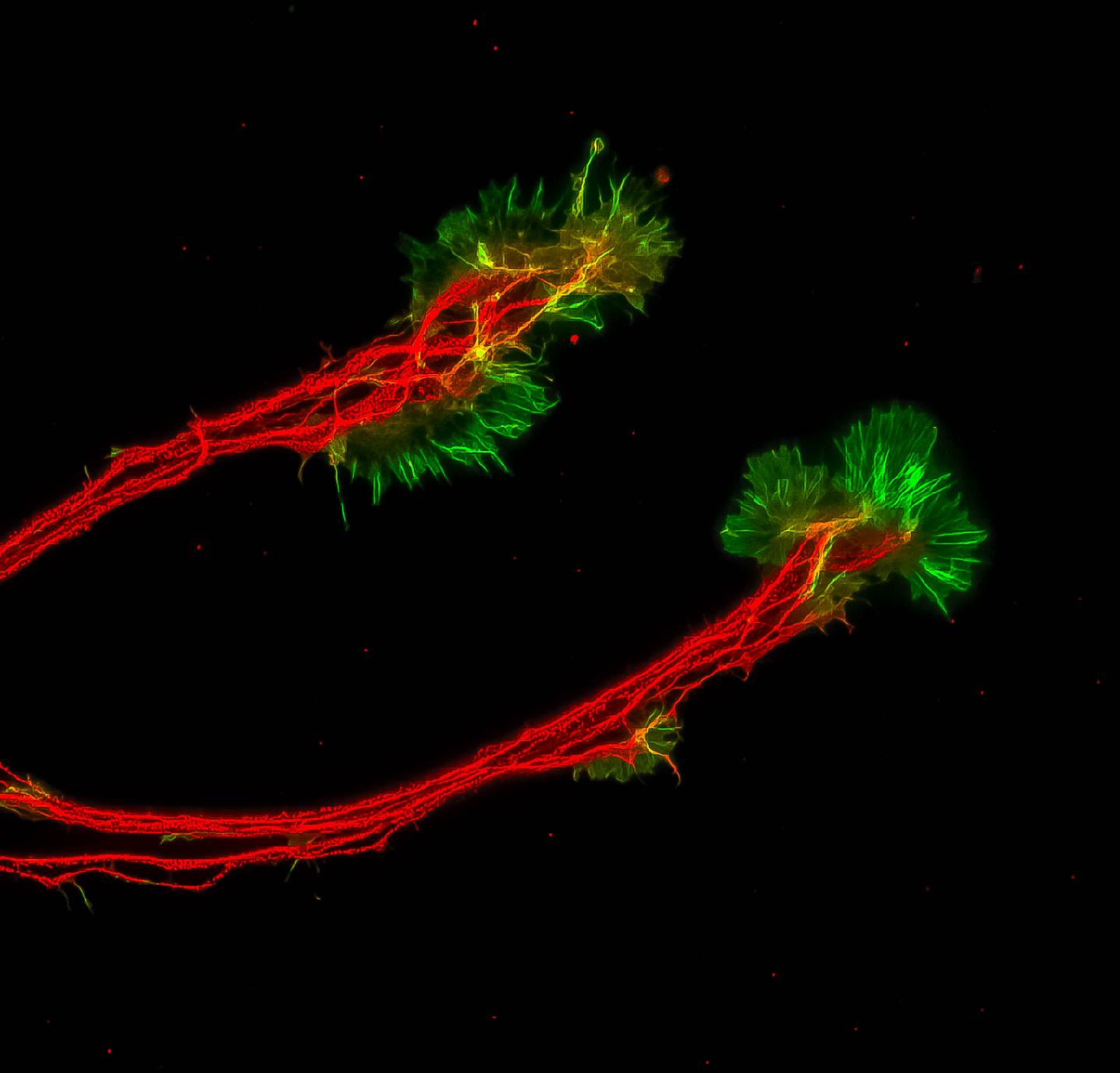 Neurites Growth Cone [IMAGE] | EurekAlert! Science News Releases