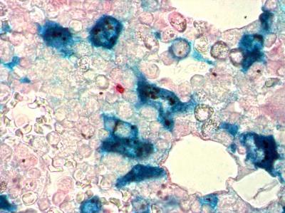 Malaria Parasites Get Down to [IMAGE] | EurekAlert! Science News Releases