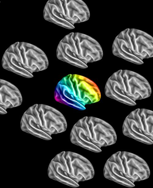 Autistic Brains [IMAGE] | EurekAlert! Science News Releases