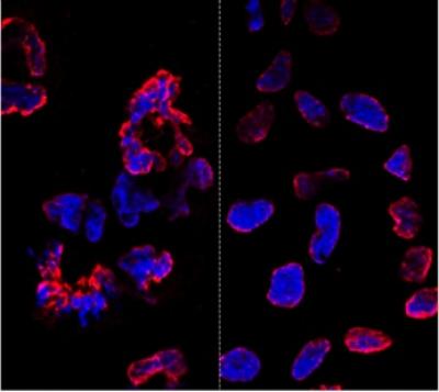 Gene-Editing Comparison [IMAGE] | EurekAlert! Science News Releases
