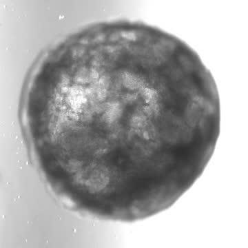 Self-organizing human heart organoids | EurekAlert!