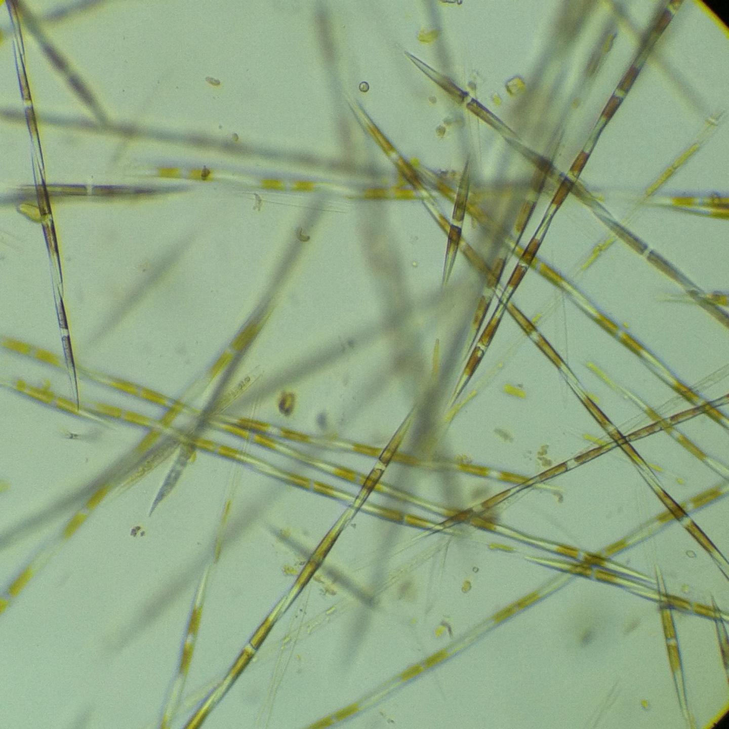 Pseudo-nitzschia [IMAGE] | EurekAlert! Science News Releases