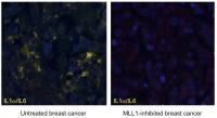 Enzyme key to link between age-related inflam | EurekAlert!