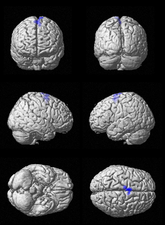 Brain Activation [IMAGE] | EurekAlert! Science News Releases