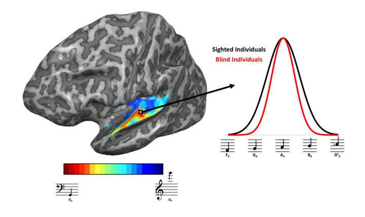 Brains of blind people adapt to sharpen sense | EurekAlert!