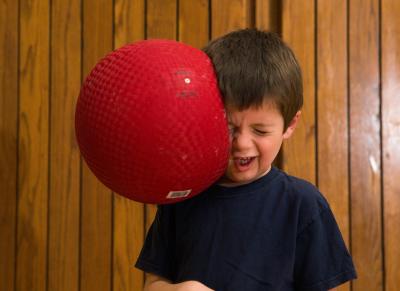 Dodgeball Hitting Face [IMAGE] | EurekAlert! Science News Releases