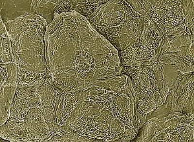Keratinocytes [IMAGE] | EurekAlert! Science News Releases