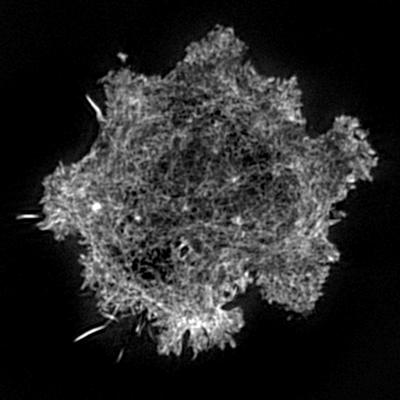Natural Killer Cell in Action [IMAGE] | EurekAlert! Science News Releases