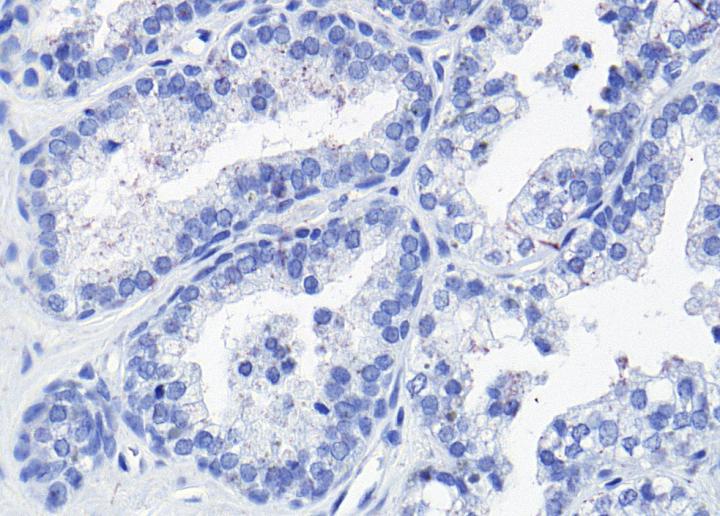 Unexpected Protein Modification Makes Prostat | EurekAlert!