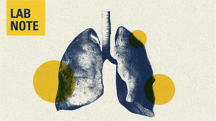 Lungs Lab Note [IMAGE] | EurekAlert! Science News Releases