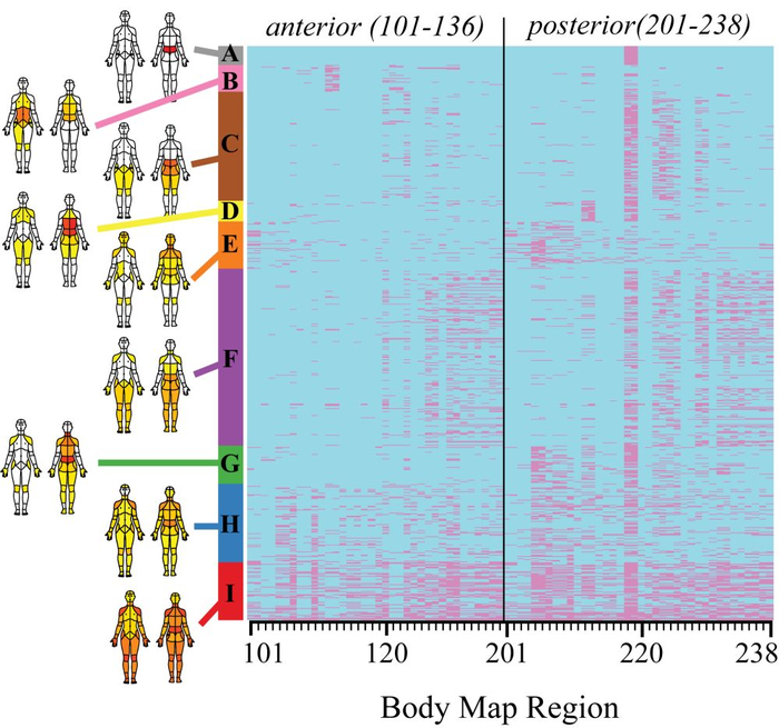 “Where does it hurt?” predicts chronic pain o | EurekAlert!