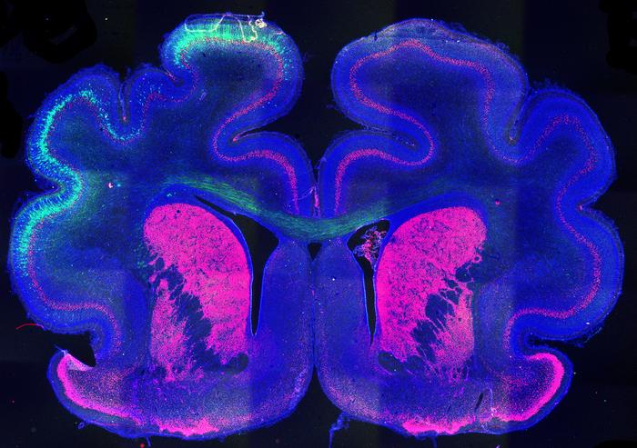 Image of a ferret brain showin [IMAGE] | EurekAlert! Science News Releases