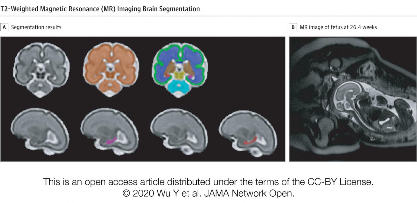T2-Weighted Magnetic Resonance [IMAGE] | EurekAlert! Science News Releases