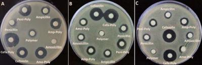 Disk Diffusion Assays [IMAGE] | EurekAlert! Science News Releases