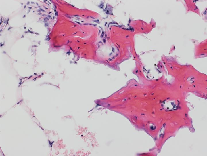 Bone [IMAGE] | EurekAlert! Science News Releases