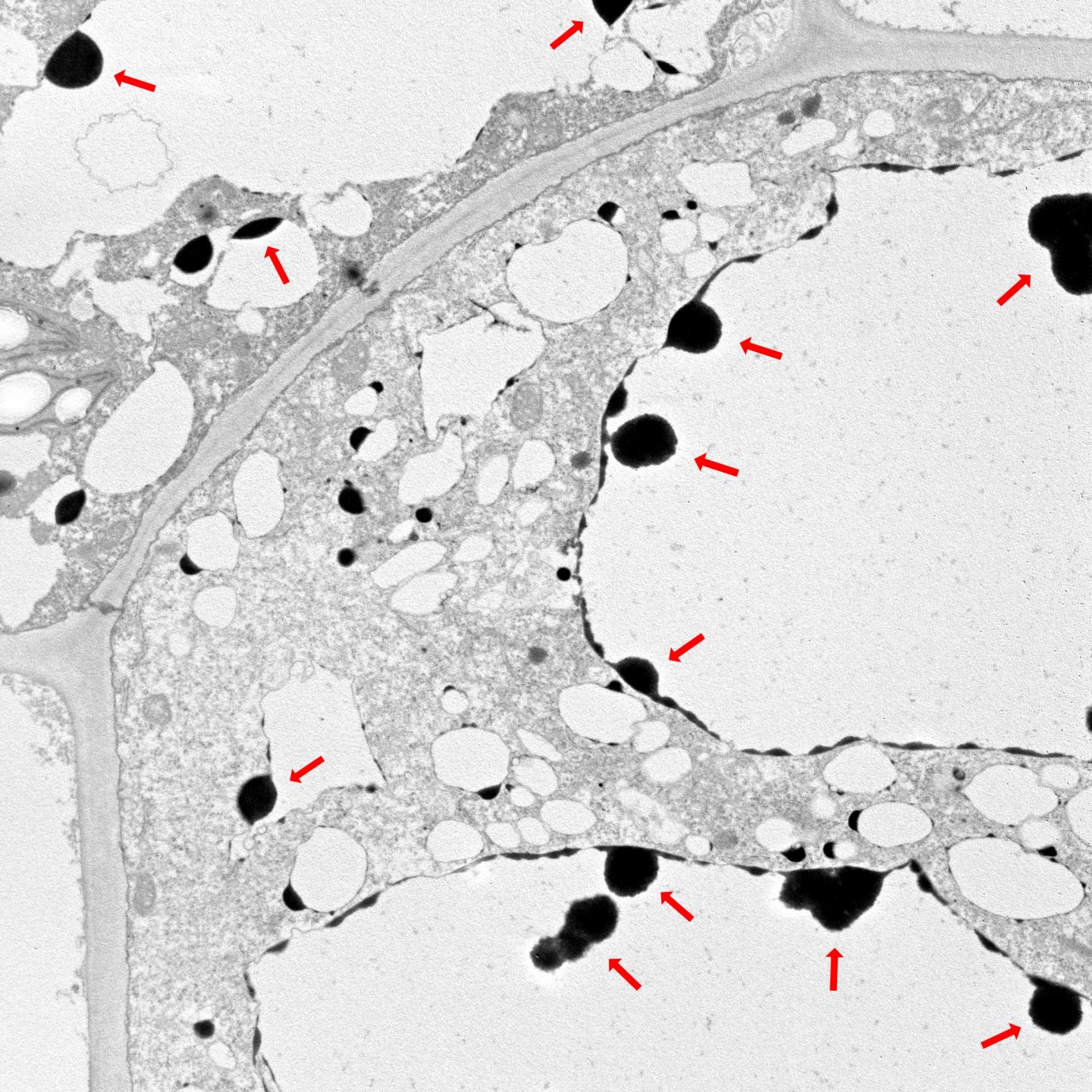 Electron-Dense Bodies Suggesti [IMAGE] | EurekAlert! Science News Releases