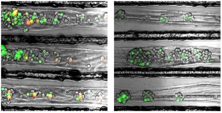 Viruses Traveling in Neurons [IMAGE] | EurekAlert! Science News Releases