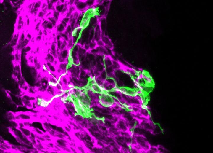 Brain Confetti [IMAGE] | EurekAlert! Science News Releases