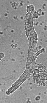 How do Pacemaker Cells in the Heart and Gut G | EurekAlert!