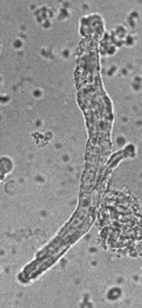 How do Pacemaker Cells in the Heart and Gut G | EurekAlert!