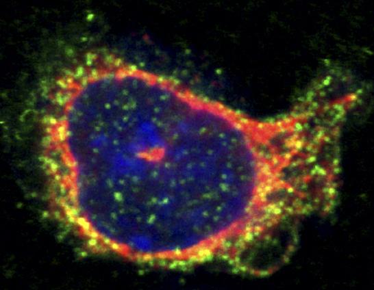 Kinesin-1 Controls Inflammator [IMAGE] | EurekAlert! Science News Releases