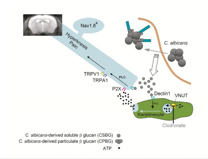 Dectin-1-mediated pain is critical for the re | EurekAlert!