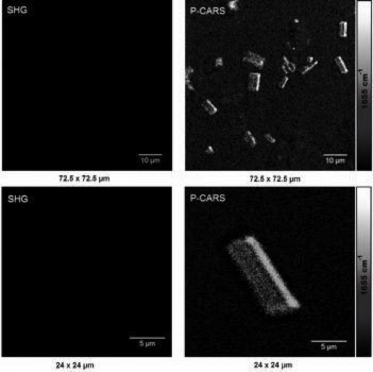 Comparison of CARS with SHG [IMAGE] | EurekAlert! Science News Releases