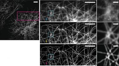 Super Resolution Microscopy [IMAGE] | EurekAlert! Science News Releases