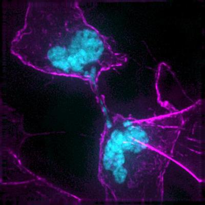 Chromosome Segregation Errors Provide Two Rou | EurekAlert!
