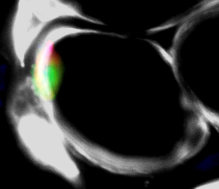 Mouse muscle [IMAGE] | EurekAlert! Science News Releases