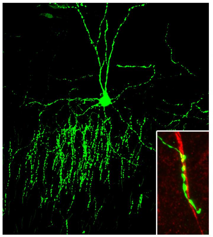 Chandelier Cells [IMAGE] | EurekAlert! Science News Releases
