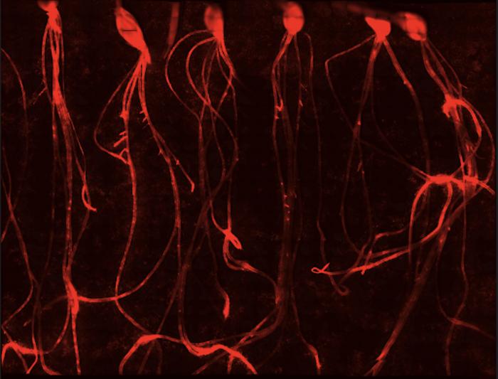 Visualisation of a root pathog [IMAGE] | EurekAlert! Science News Releases