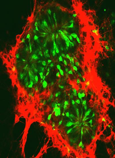 Photoreceptor Cells [IMAGE] | EurekAlert! Science News Releases