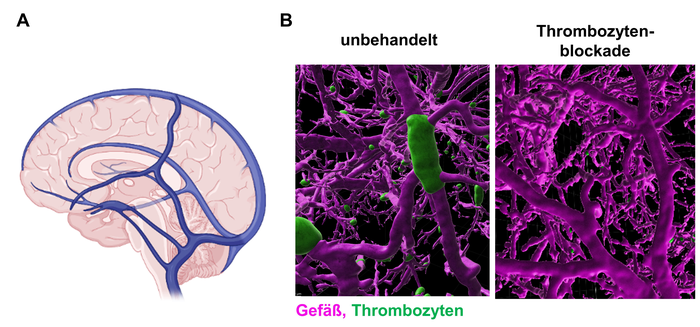 Molecular mechanism of cerebral venous thromb | EurekAlert!