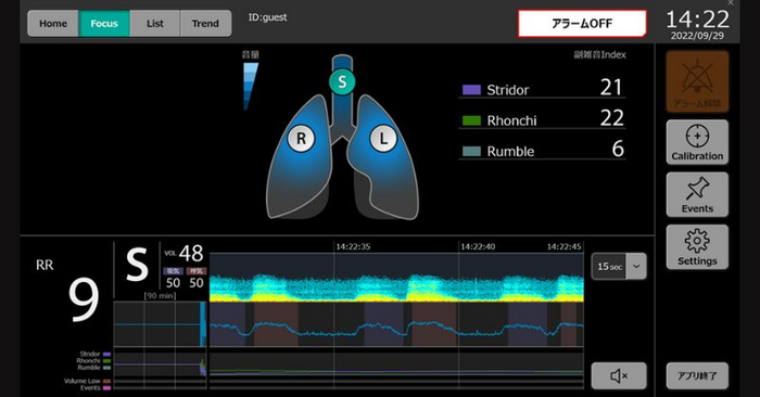 Novel device monitors breath sounds to predic | EurekAlert!