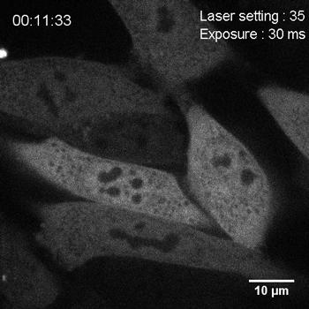 Protein Droplets in a Cell [IMAGE] | EurekAlert! Science News Releases