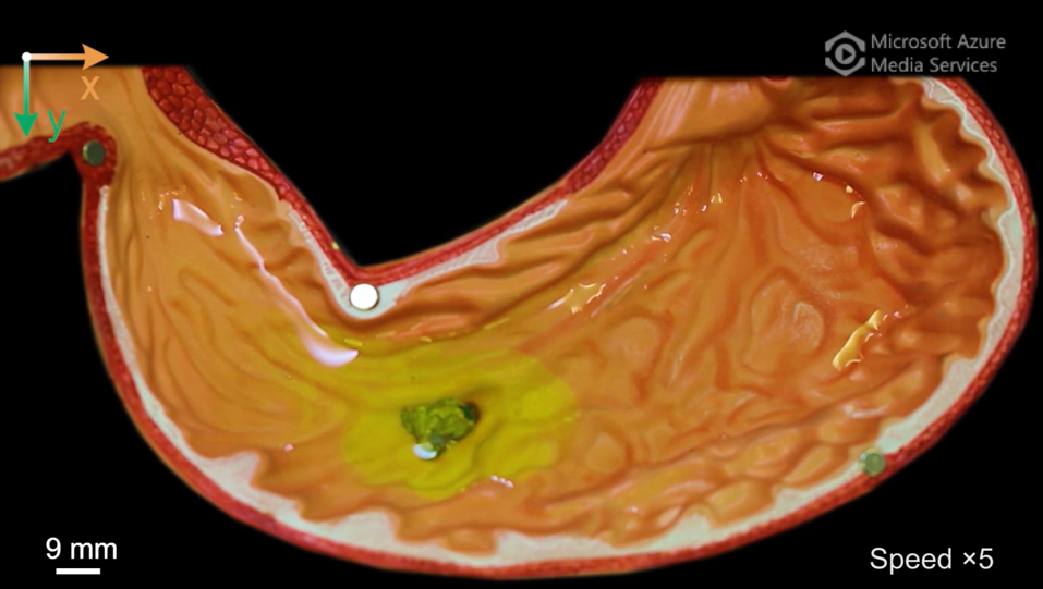 Robot delivers a drug into a m [VIDEO] | EurekAlert! Science News Releases