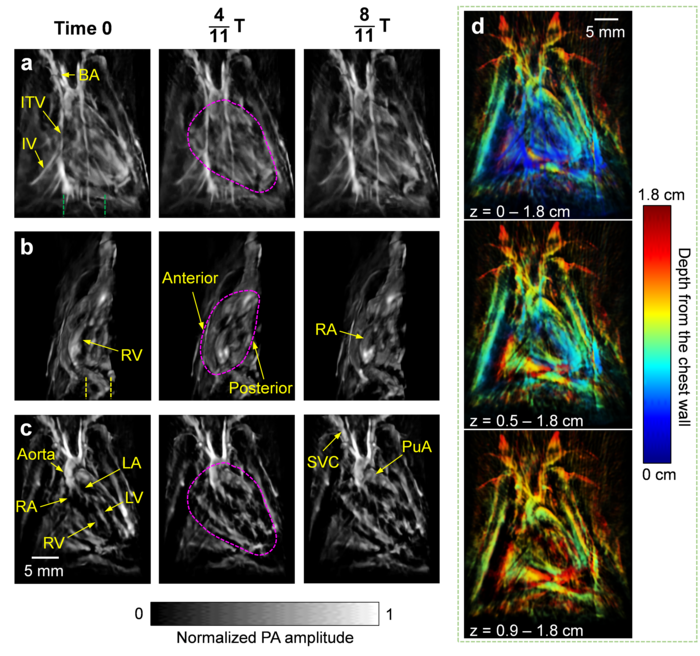Rat heart anatomy acquired by [IMAGE] | EurekAlert! Science News Releases