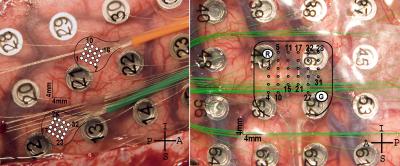 2 Kinds of Microelectrode Arra [IMAGE] | EurekAlert! Science News Releases