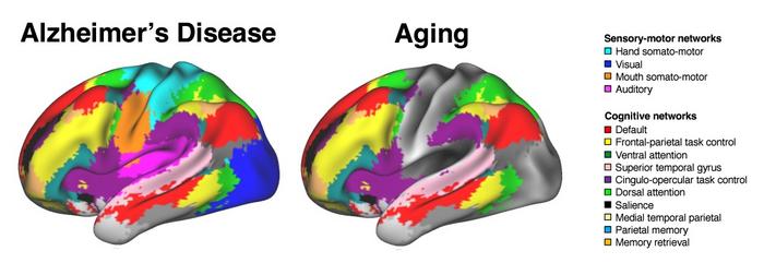 Study reveals broader impact of Alzheimer’s o | EurekAlert!