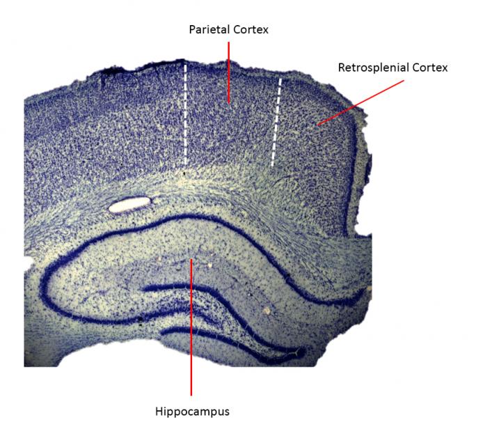 Rat Brain -- Retrosplenial Cor [IMAGE] | EurekAlert! Science News Releases