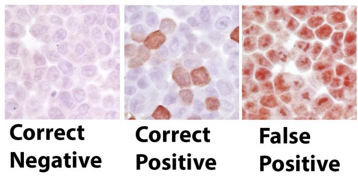 IHC Staining [IMAGE] | EurekAlert! Science News Releases